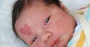 Baby Boy Born With A Heart Shaped Birthmark On His Forehead Baby Boy Born With A Heart Shaped Birthmark On His Forehead