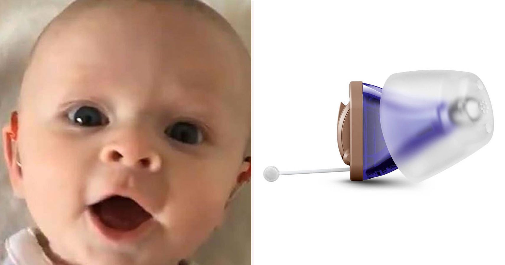 Video Shows Sound Of Joy When A Baby's Hearing Aid Is Turned On