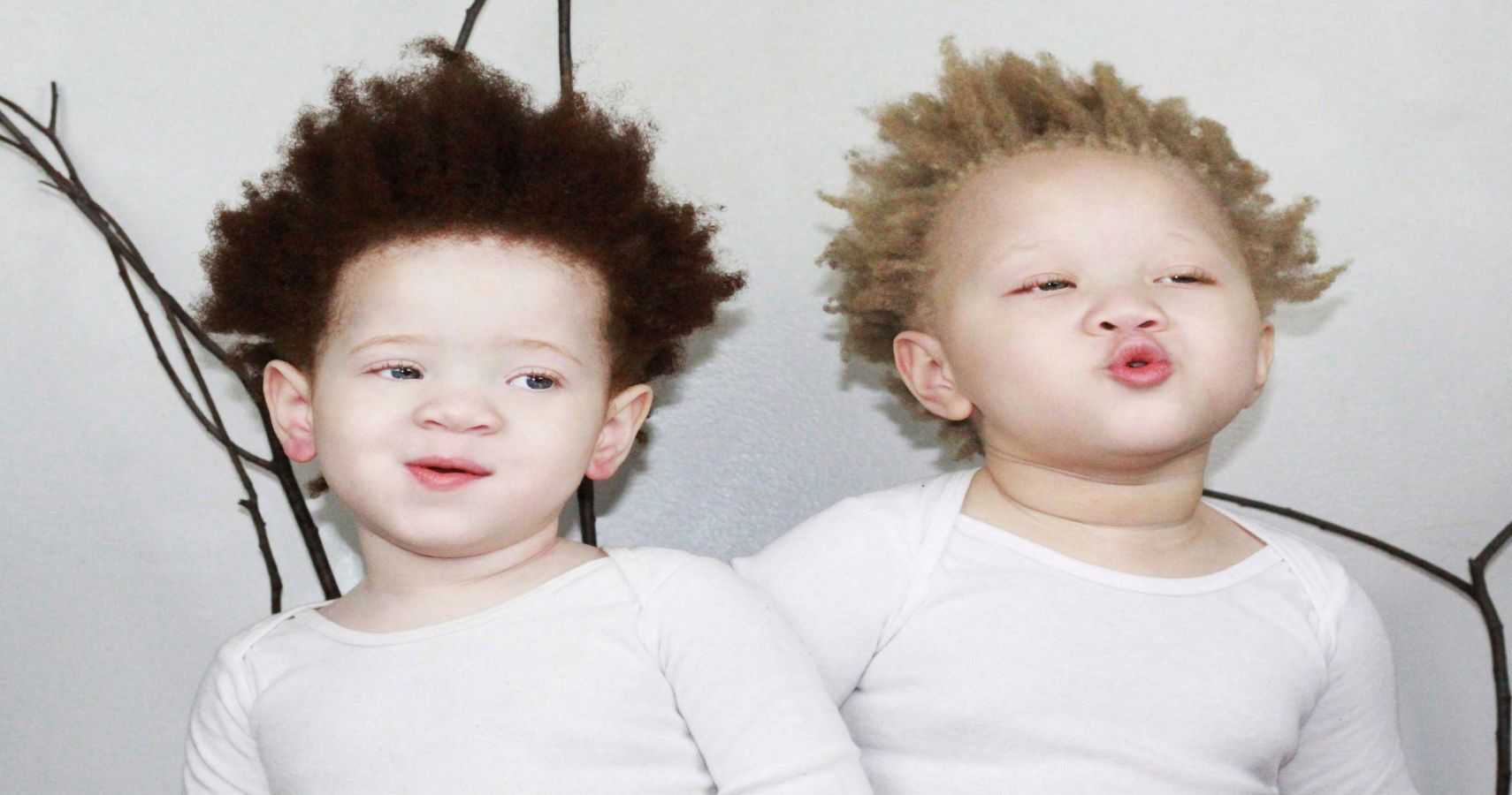 Mom Of Albino 21-Month-Old Speaks Out After He’s Turned Into A Meme