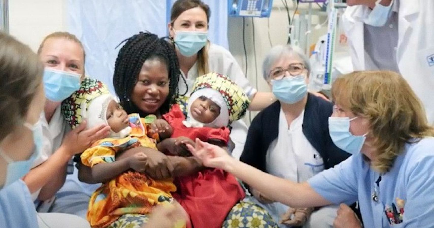 Doctor Shares Story Of Conjoined Craniopagus Twins & It's Amazing