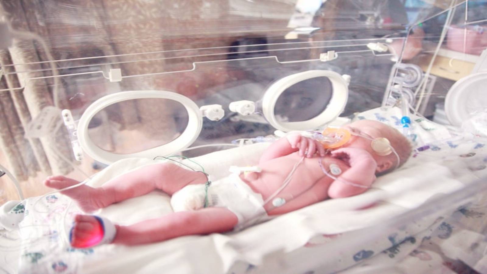 Baby Born At 24-Weeks Just Over A Pound Turns One: 'His Birthday Feels ...