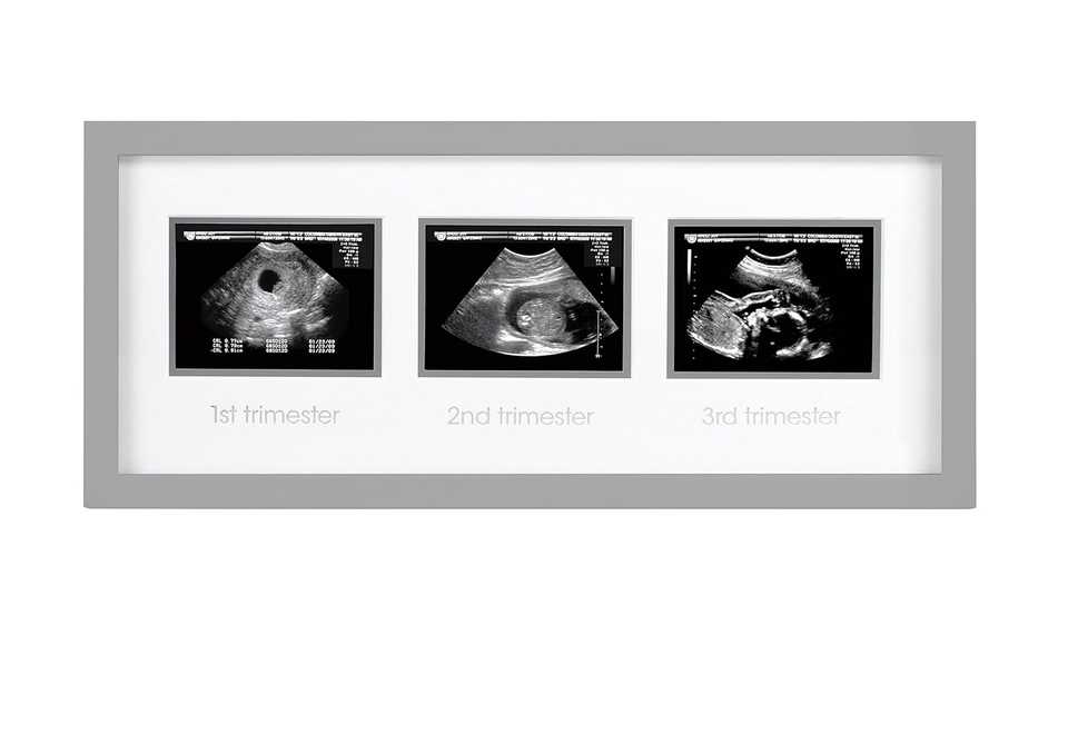 Gift Ideas For Pregnant People Experiencing Morning Sickness