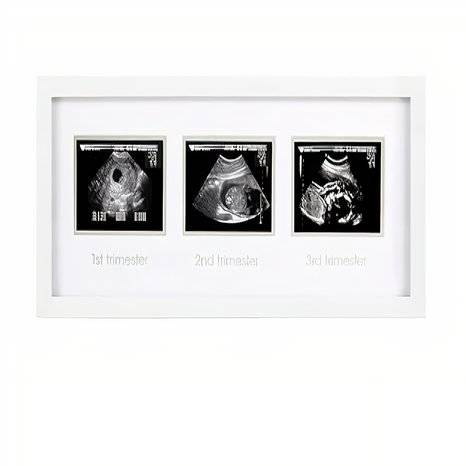 Best Gift Ideas For Pregnant People In Their First Trimester